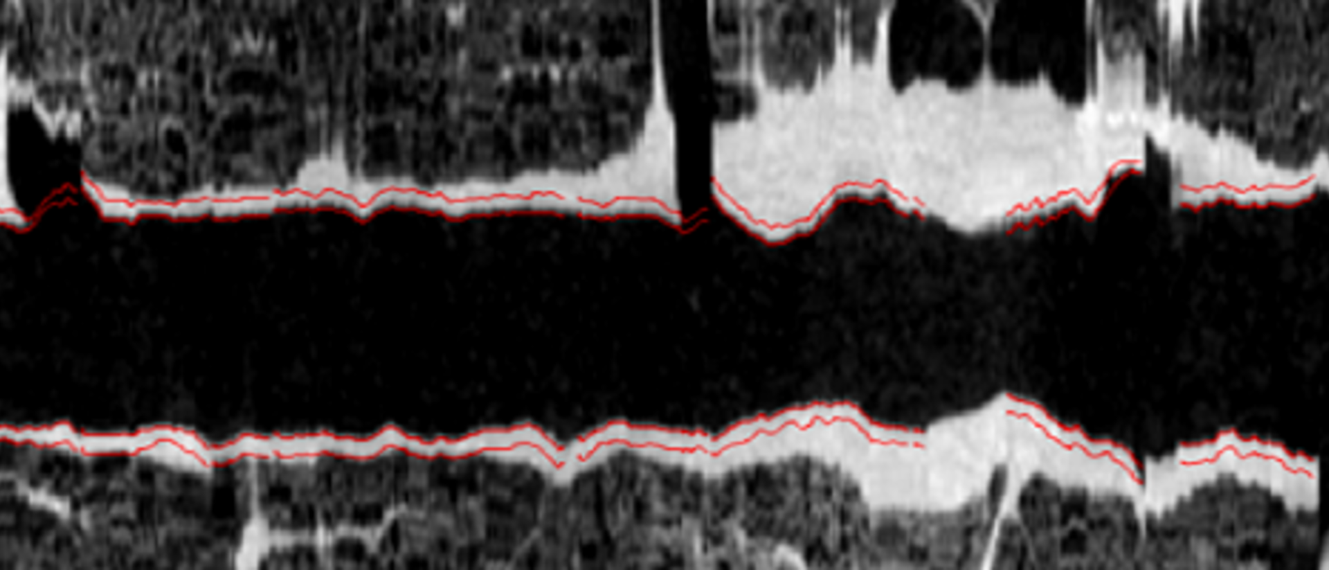 The Reinhardt Biomedical Imaging Lab | The University of Iowa