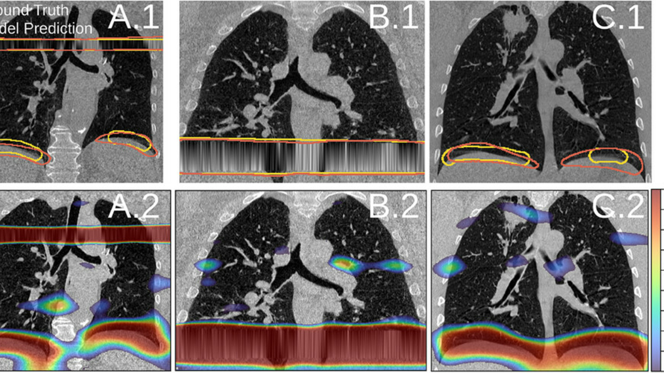 The Reinhardt Biomedical Imaging Lab | The University of Iowa