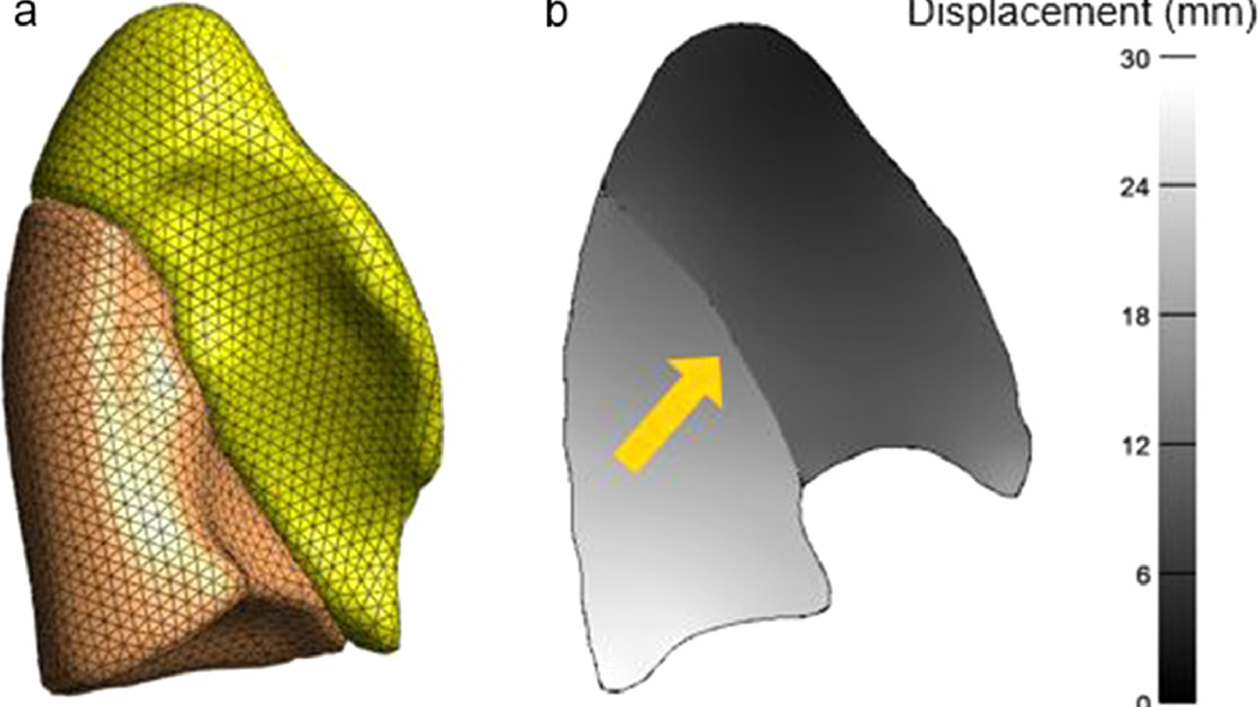 The Reinhardt Biomedical Imaging Lab | The University of Iowa